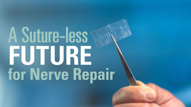 A Suture-less Future for Nerve Repair | Medical College of Virginia ...